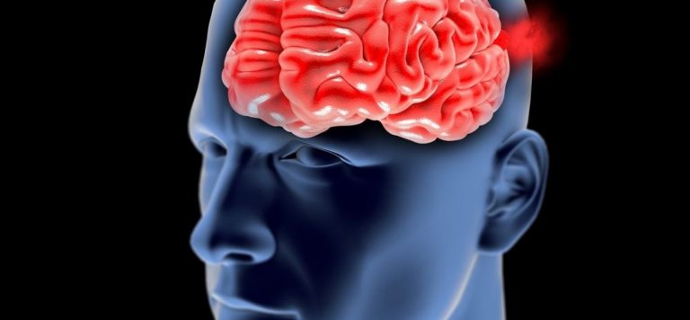 Ataxia Cerebelar tem Cura? O que é? Conheça os Sintomas