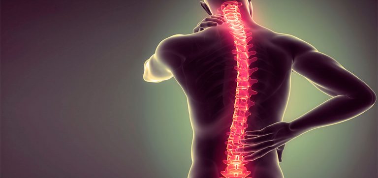 O que é Dorsalgia (Dor nas Costas), Sintomas, Tratamento e Mais