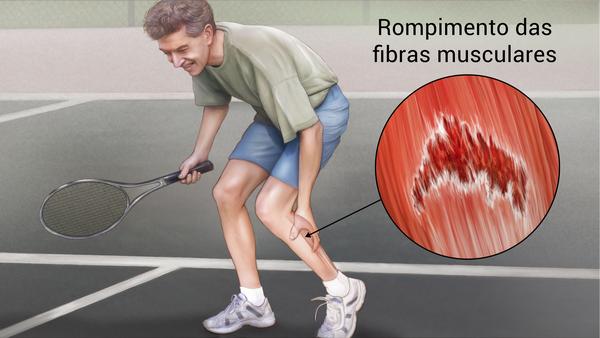 estiramento-muscular2 | Saúde – Blog OPAS