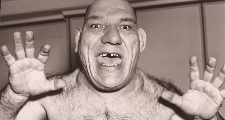 Acromegalia: Quais os Sintomas e as Causas?